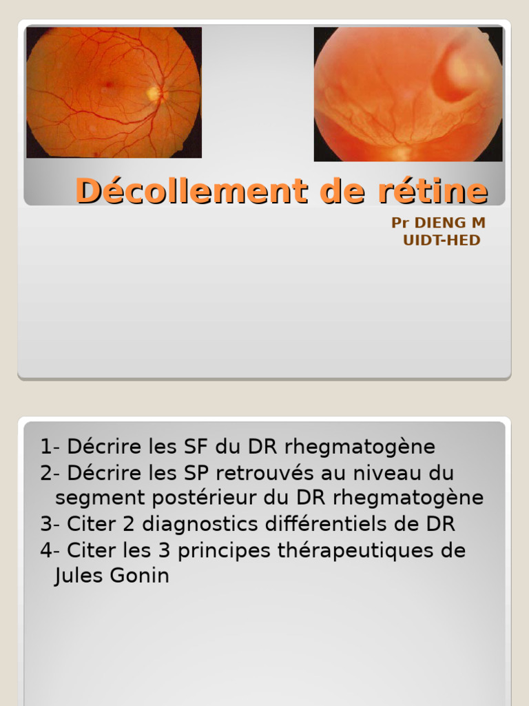 Décollement de rétine rhegmatogène | PDF | Rétine | Système visuel