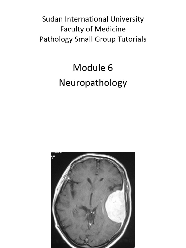 Neuropathology Tutorials at SIU | PDF