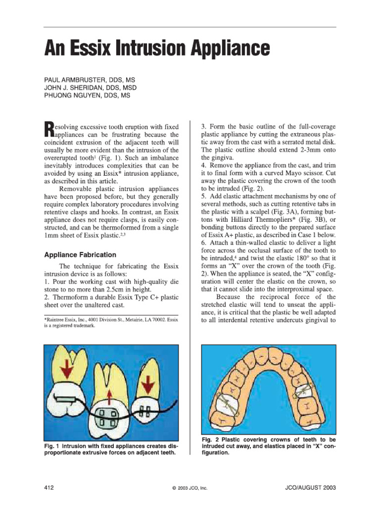 Intrusion Through Essix Retainer | PDF