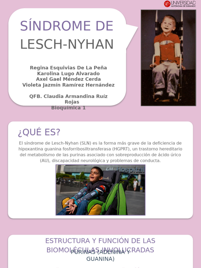 Síndrome de Lesch-Nyhan: Causas y Síntomas | PDF | Medicina CLINICA ...