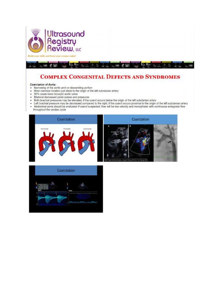 USRR Echo Complex Congenital Defects and Syndromes | PDF