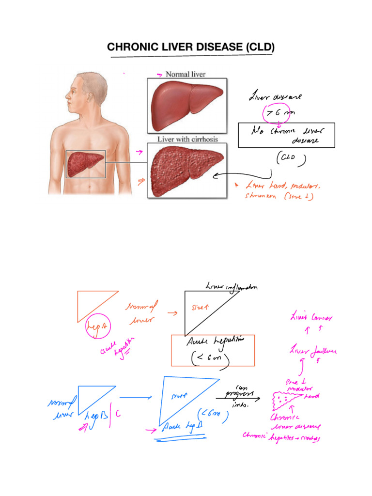 Clinical 3.0 - CLD - Causes and Clinical Features | PDF