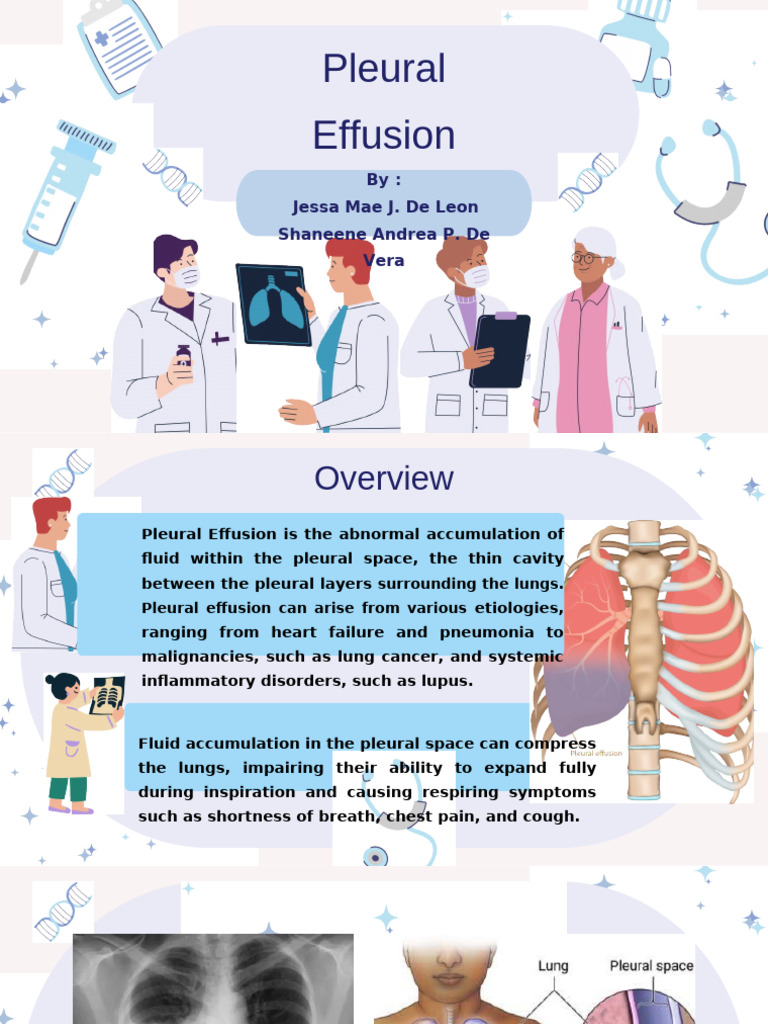 Pleural Effusion | PDF | Lung | Thorax (Human Anatomy)