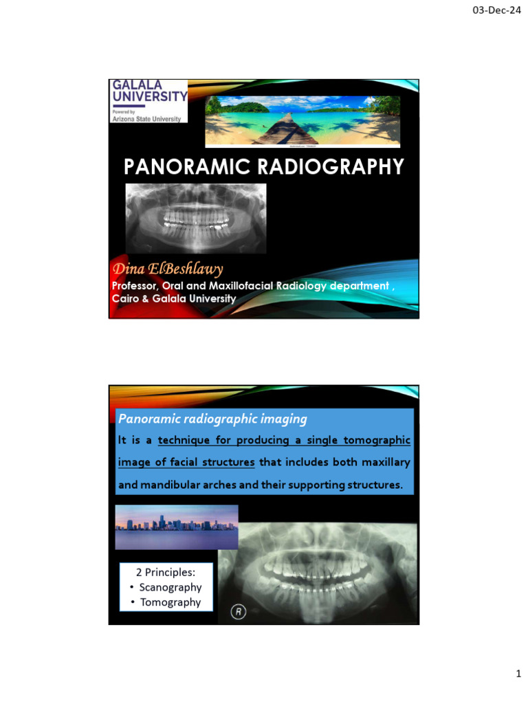 Lec 7 Panoramic Radiography Part 1 | PDF | Radiography | Medical ...