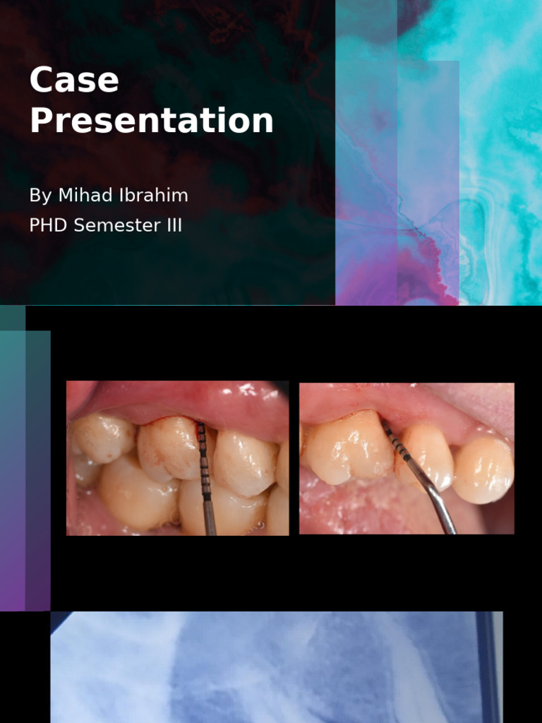 Presentation1 2 | PDF