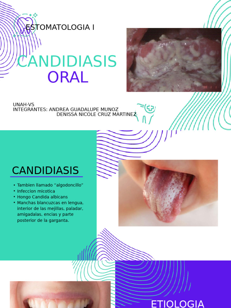 Candidiasis Oral | PDF | Candidiasis | Enfermedades y trastornos