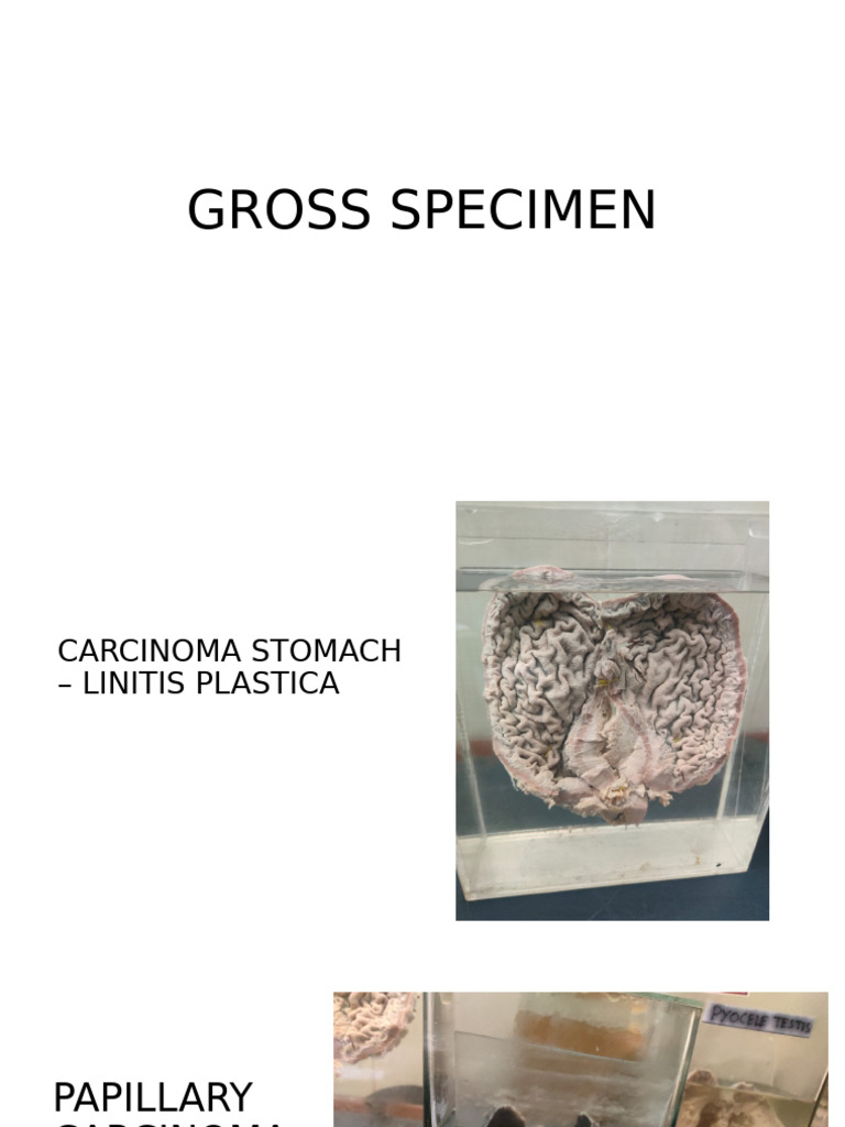 Gross Specimen-1 | PDF