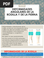 Ejercicios para Rodillas Valgas, Como Enderezar Piernas, Rodilla en X ...