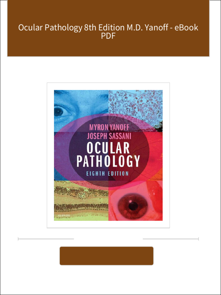 Ocular Pathology 8Th Edition M.D. Yanoff - Ebook PDF: or Click Button ...
