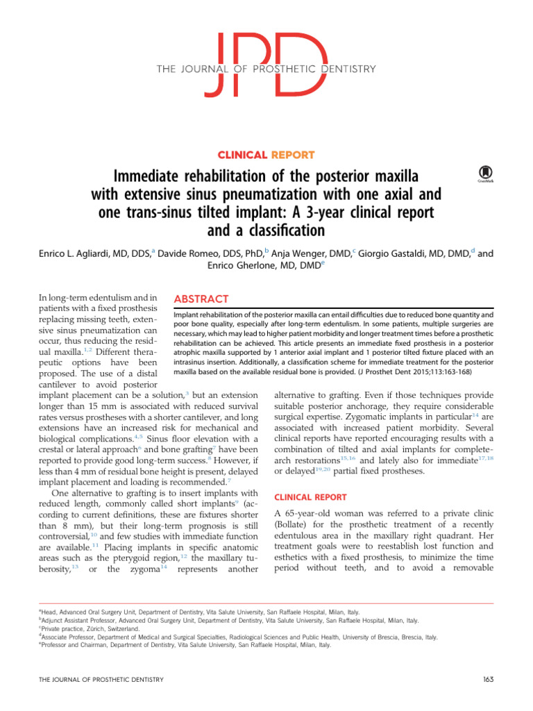 Agliardi Et Al 2015. One Axial and One Trans-Sinus Tilted Implant. JPD ...
