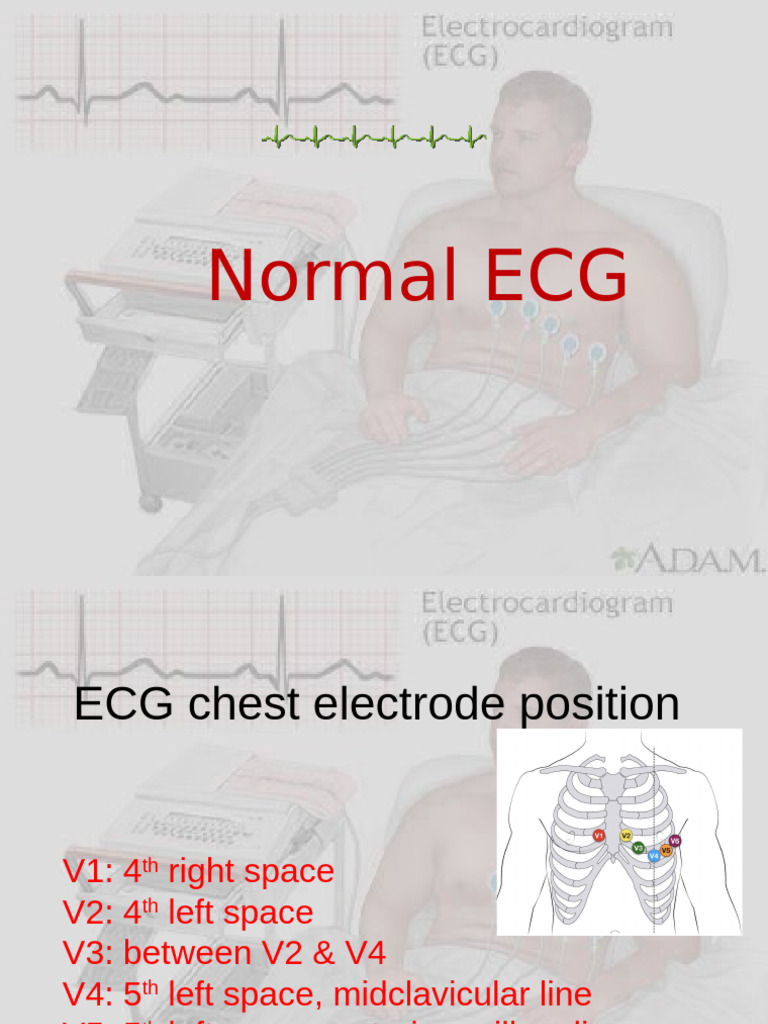 Main Points Normal ECG | PDF