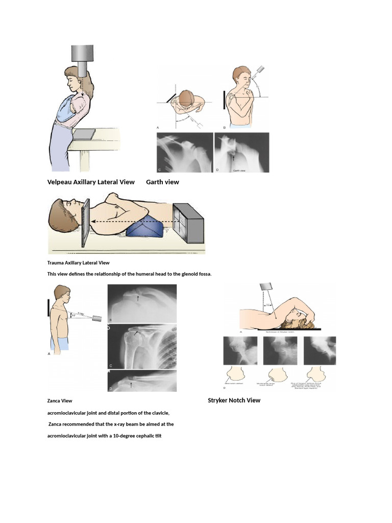 Velpeau and Trauma Axillary Views | PDF