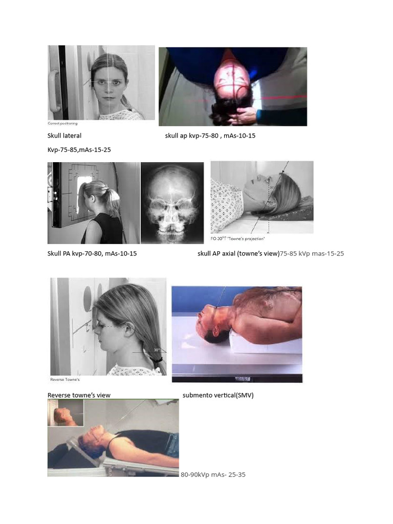 Skull Imaging Techniques and Settings | PDF