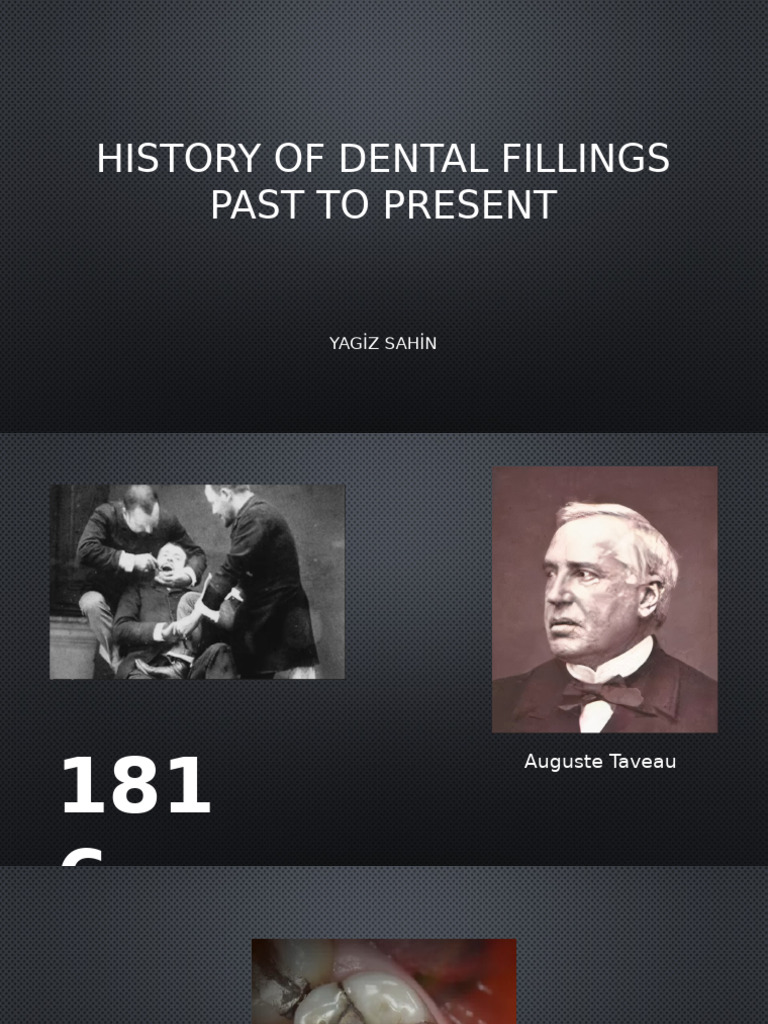 History of Dental Fillings Past To Present | PDF