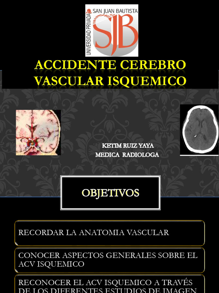 ACV Isquémico: Diagnóstico y Tratamiento | PDF | Isquemia | Carrera