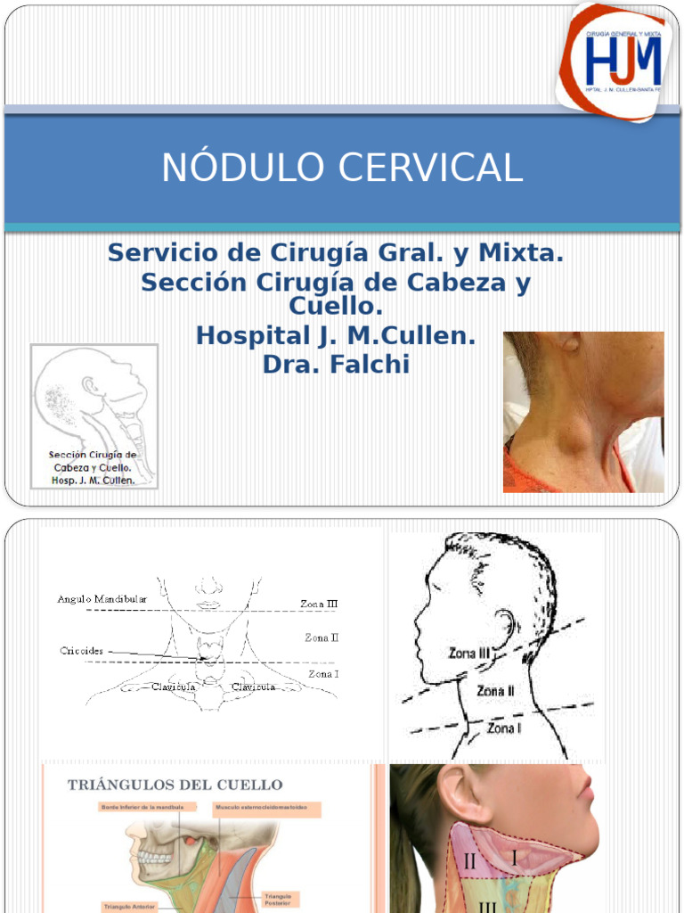 Diagnóstico y Manejo de Nódulos Cervicales | PDF | Biopsia | Neoplasias