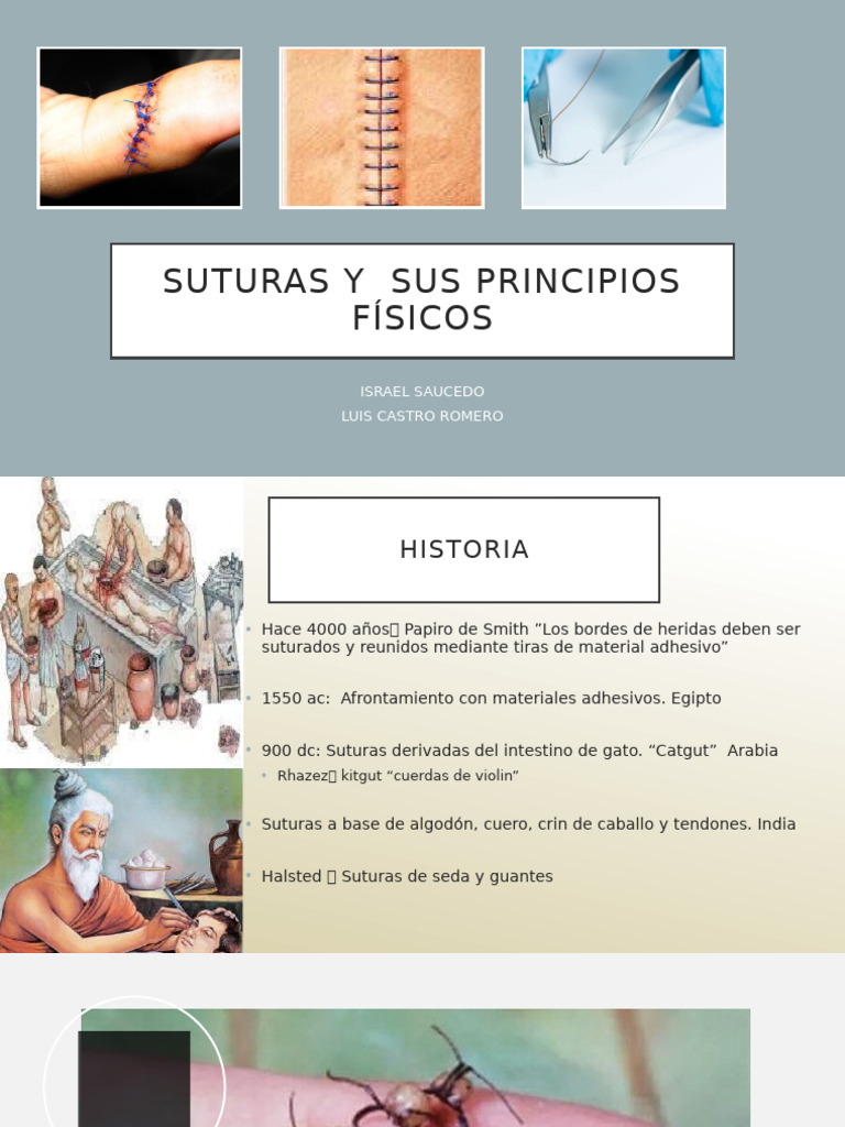 Guía Completa de Suturas Quirúrgicas | PDF | Sutura Quirúrgica | Herida