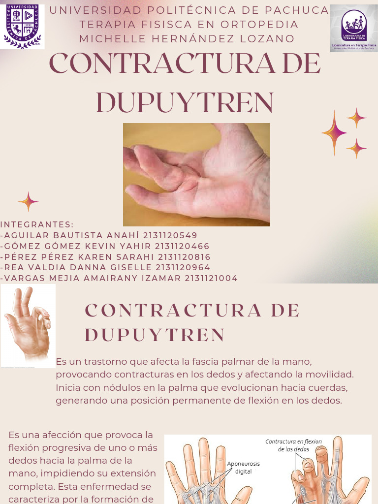 Contractura de Dupuytren: Fisiopatología y Tratamiento | PDF ...