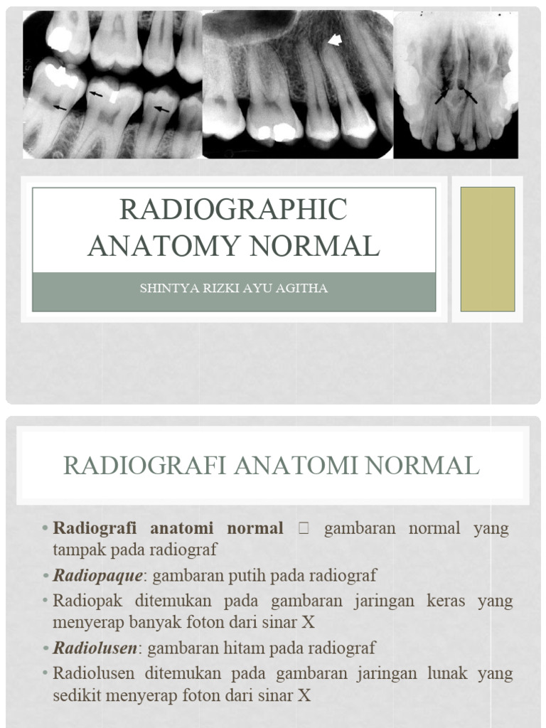 RADIOGRAPHIC ANATOMY NORMAL | PDF