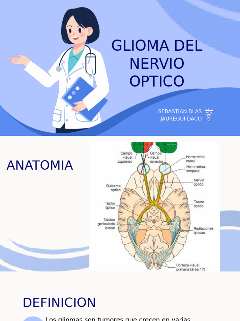 Glioma Del Nervio Optico | PDF