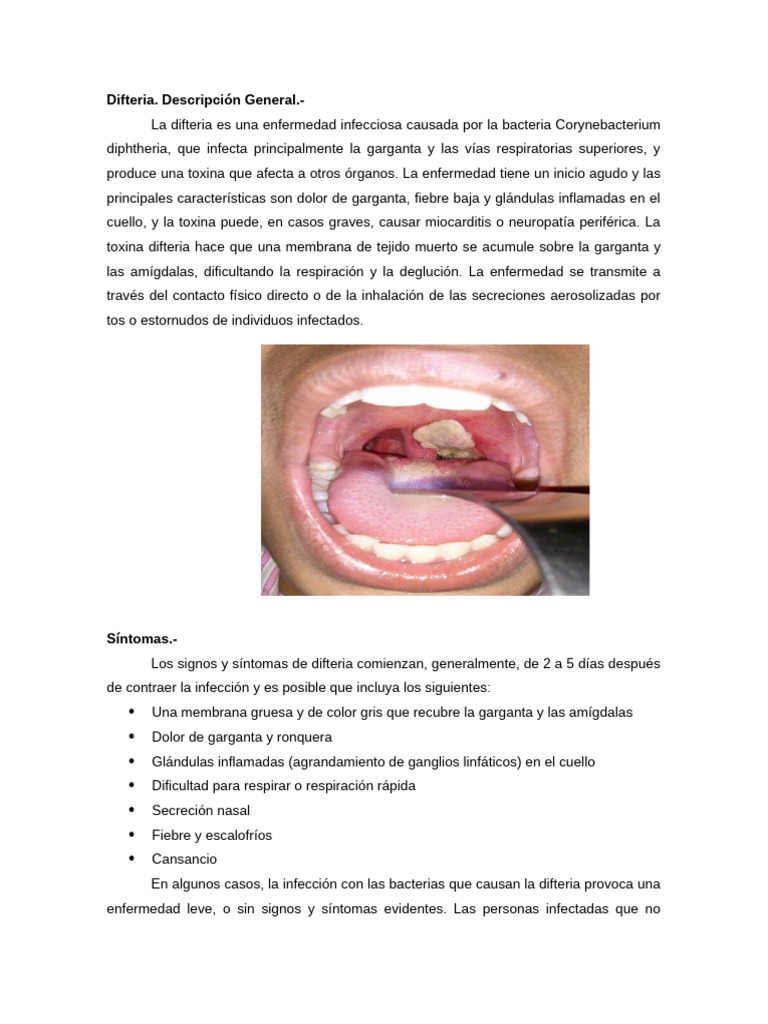 Difteria | PDF | Pediatría | Medicina CLINICA