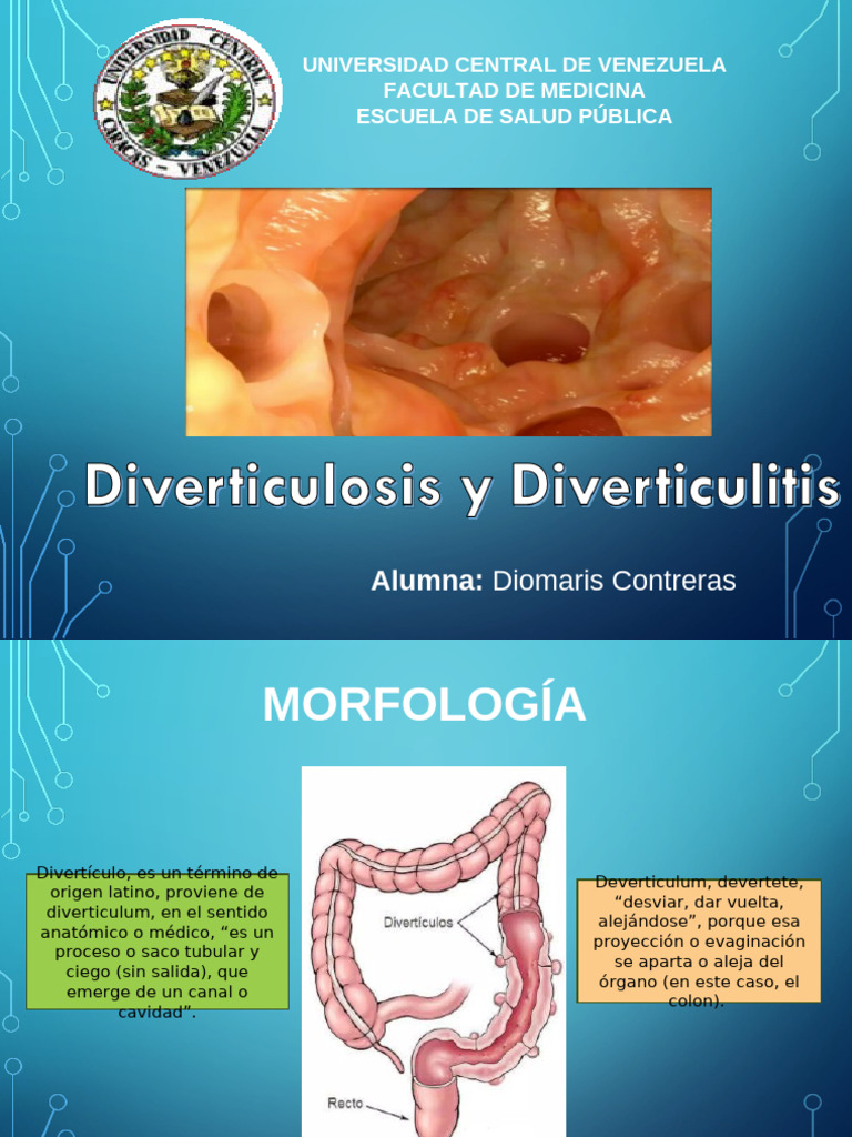 Manejo de Diverticulitis Hinchey 2 | PDF | Enfermedades y trastornos ...