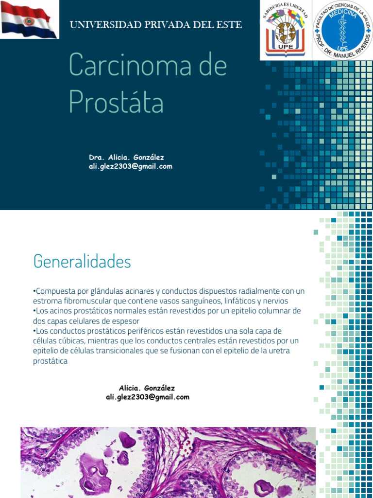 Carcinoma de Próstata: Diagnóstico y Grados | PDF | Antígeno específico ...