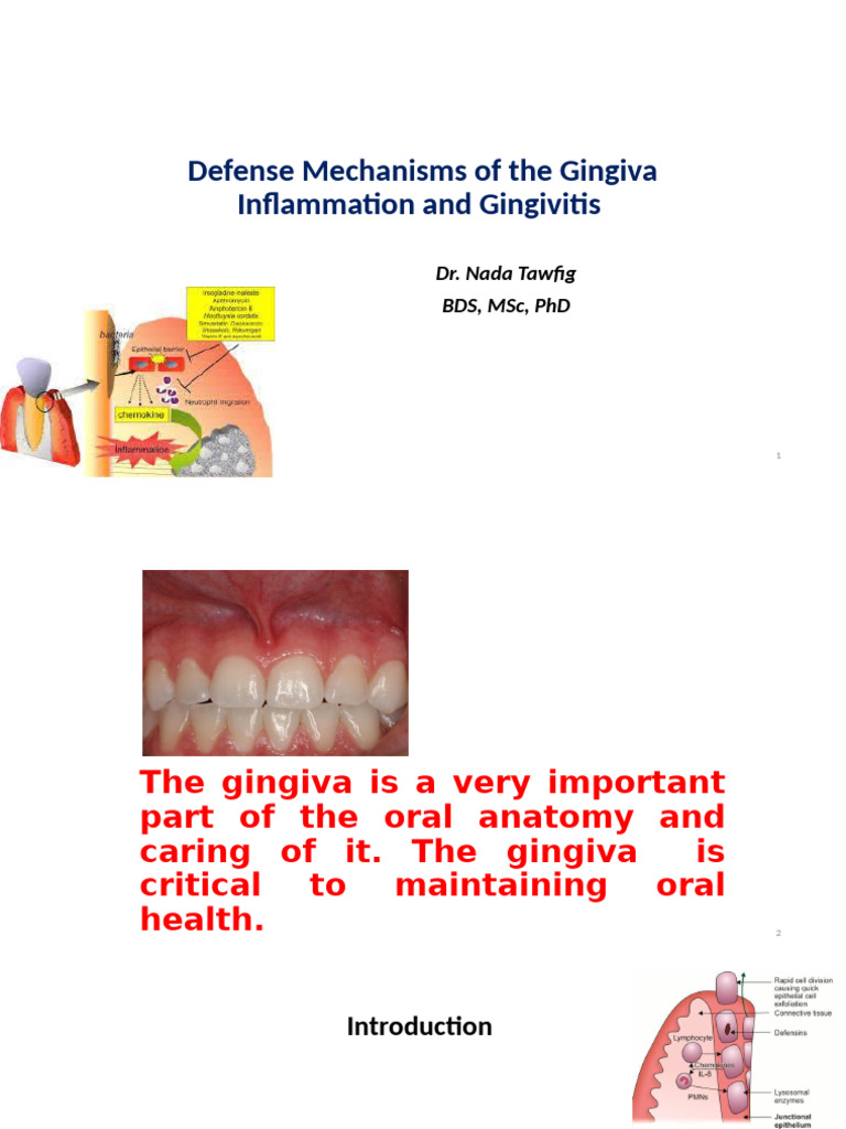 Defense Mechanisms of The GingivaInflammation and Chronic Gingivitis RAKCODS Original | PDF ...