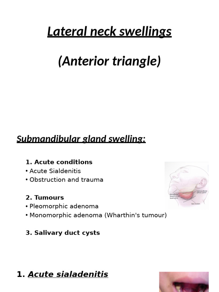 Lateral Neck Swelling | PDF | Clinical Medicine | Diseases And Disorders
