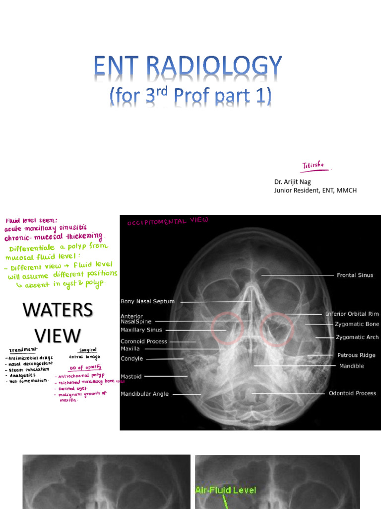 XRAYS ENT UG | PDF | Medical Specialties | Otorhinolaryngology