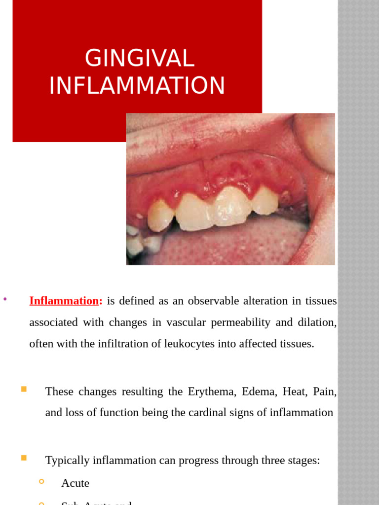 Gingival Inflammation Dr. Ch. Chaitanya | PDF | Inflammation ...