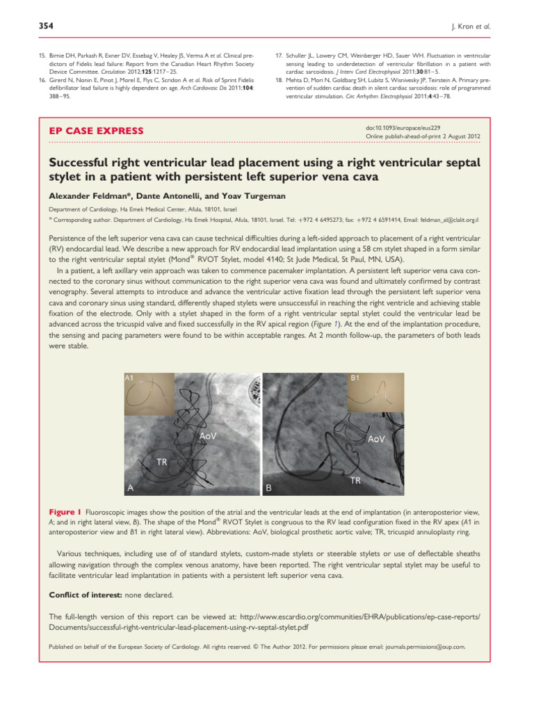 Successful Right Ventricular Lead Placement Using A Right Ventricular ...