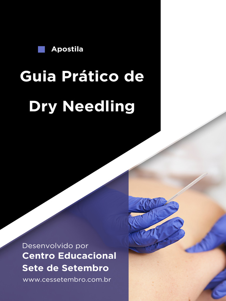 Guia Pratico de Dry Needling | PDF | Dor | Músculo