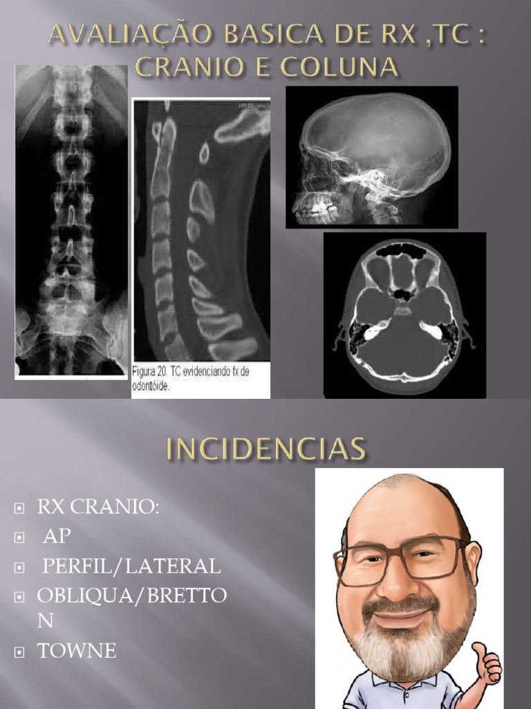 Avaliaã - Ã - o Basica de RX, TC PDF | PDF
