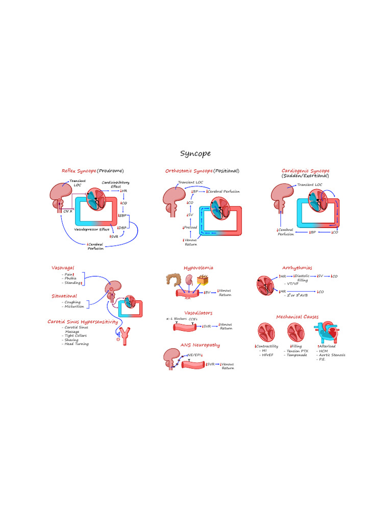 15• Syncope [Illustrations Key] | PDF | Circulatory System | Human ...