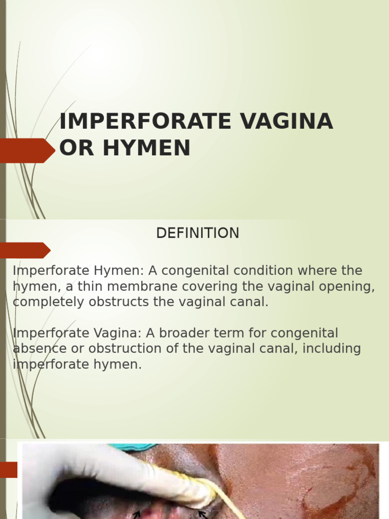 Imperforate Vagina | PDF | Vagina | Medical Specialties