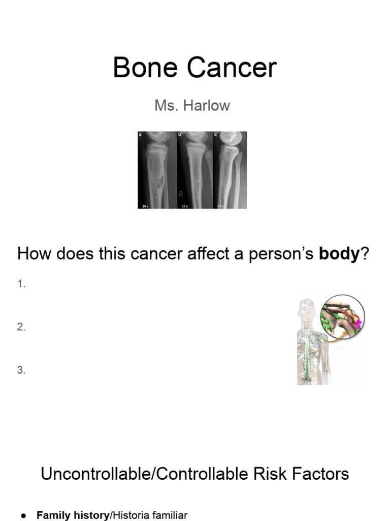 Cancer_Types_Research_Project_Outline (1) | PDF
