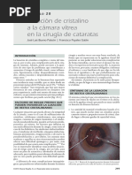 Facoemulsificación y Vitrectomía Quirúrgica | PDF | Catarata | Oftalmología