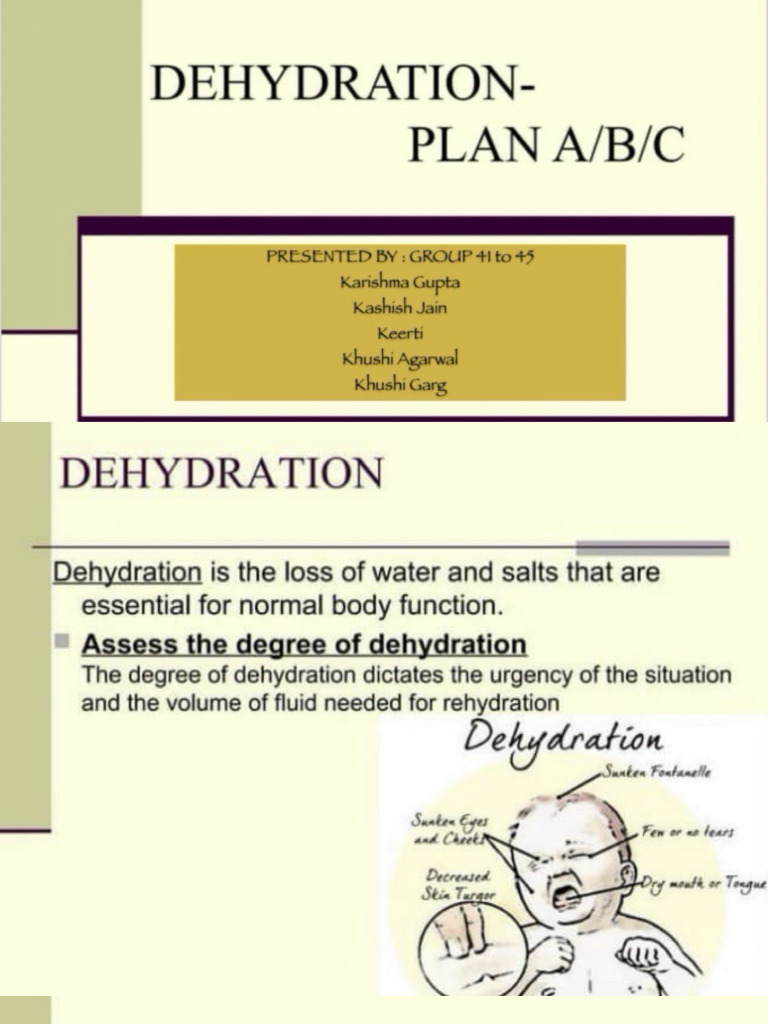 Dehydration in children- Pediatrics case | PDF