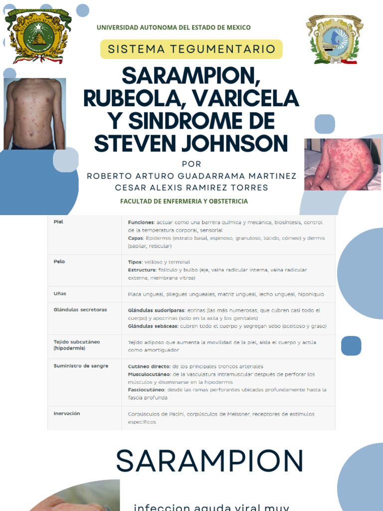 Enfermedades Virales: Sarampión, Rubéola, Varicela y Síndrome de ...
