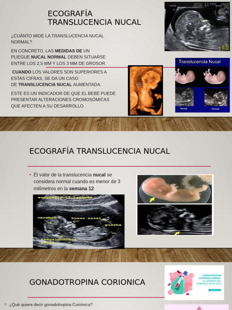 Translucencia Nucal y HCG Corionica y Estreptococo. | PDF | Gonadotropina coriónica humana ...