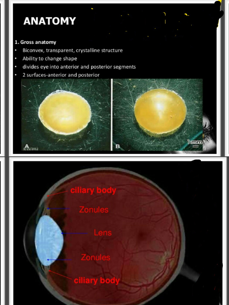 lens anatomy | PDF