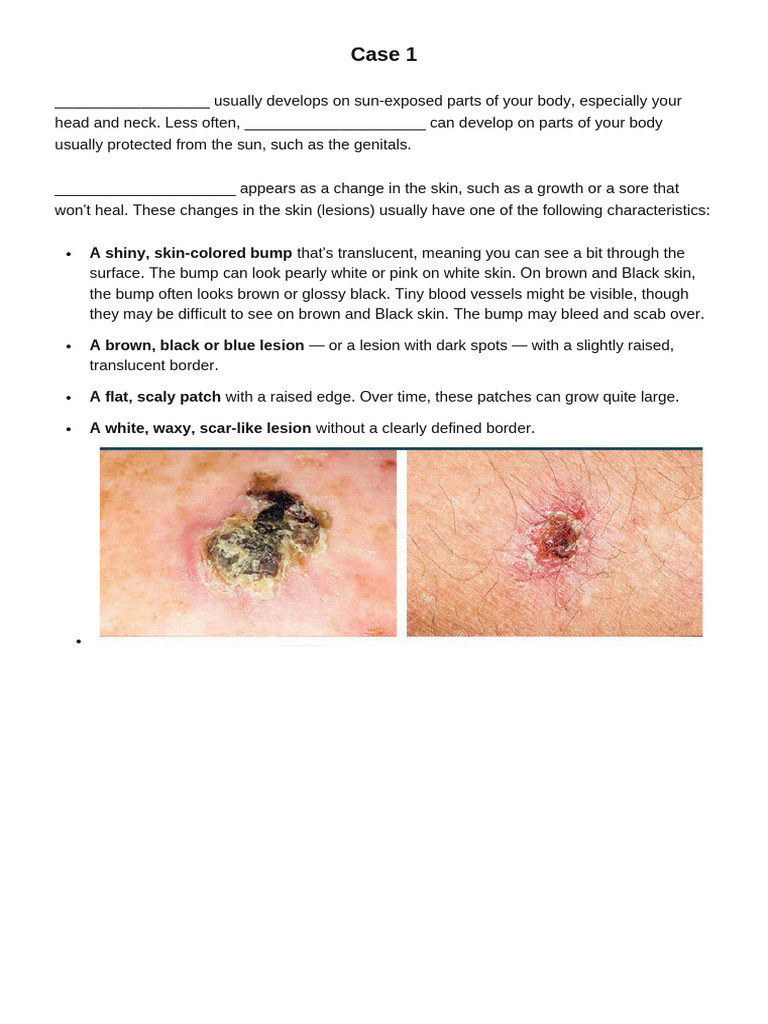 Skin Lesion Identification Guide | PDF