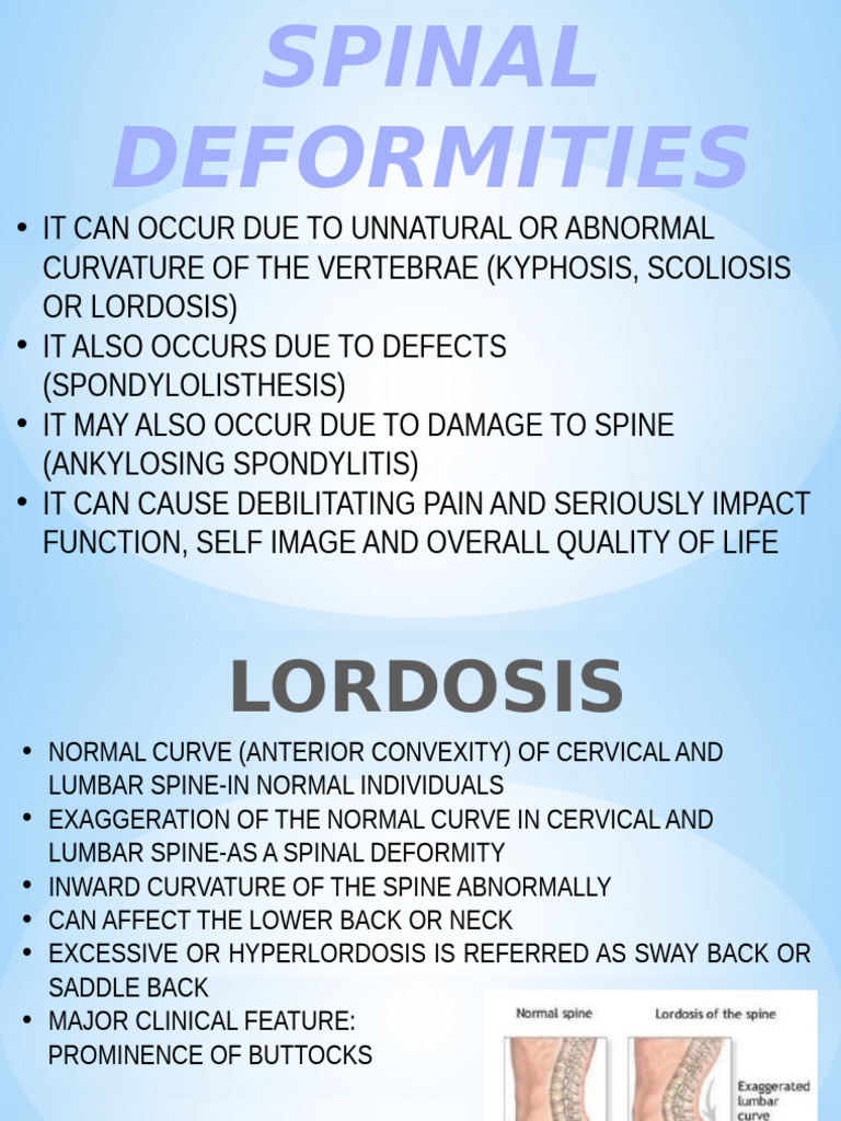 Spinal Deformities (Autosaved) | PDF | Vertebral Column ...