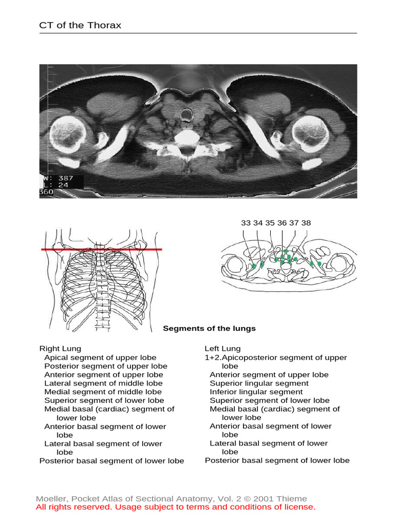 Atlas of Anatomy - CT Thorax, Abdomen, Pelvis | PDF | Abdomen | Thorax