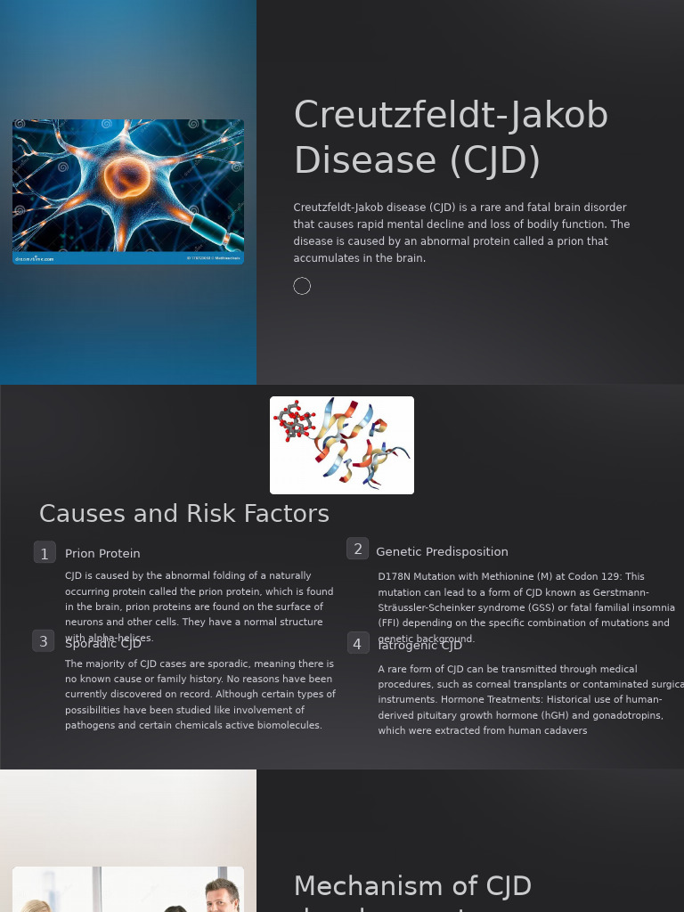 Understanding Creutzfeldt-Jakob Disease | PDF | Dementia | Neurology