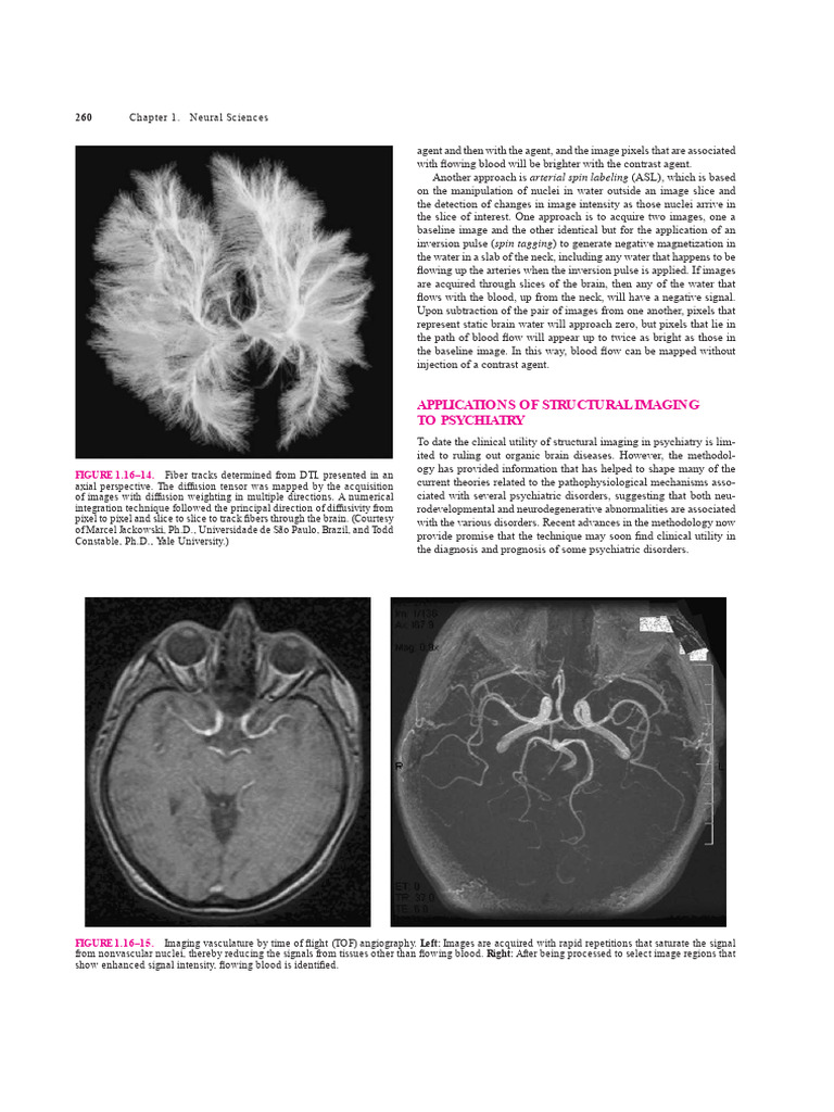 Mri 2 | PDF | Functional Magnetic Resonance Imaging | Alzheimer's Disease