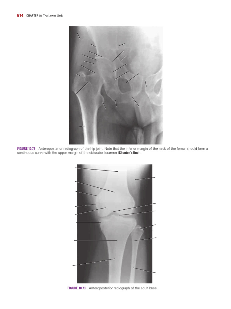 Lower Limb X-Rays (Snell) | PDF | Knee | Human Leg