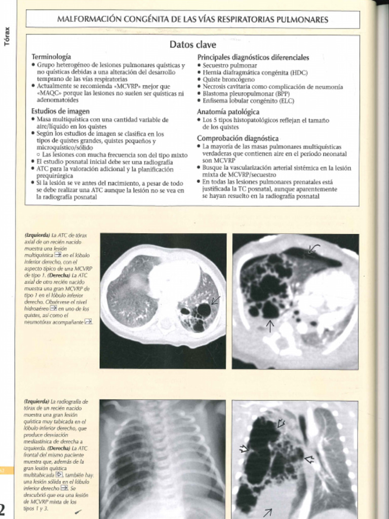 Seccion 2ct+orax | PDF