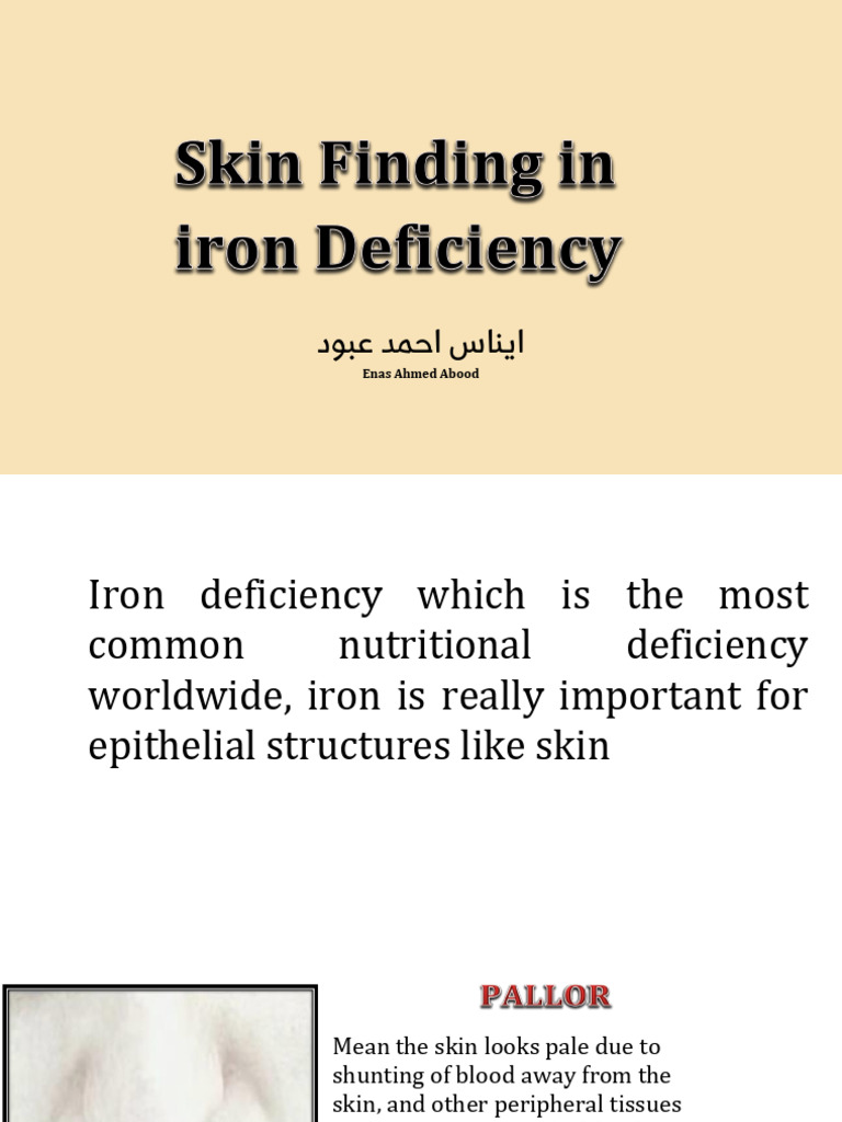 Iron Deficiency Symptoms and Effects | PDF